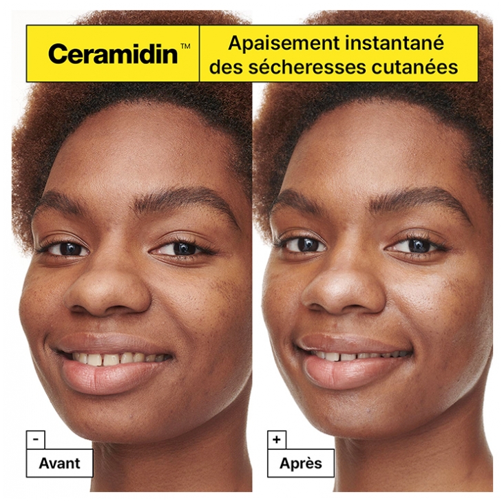 Dr. Jart+ Ceramidin Crème Visage Hydratante Protection de la Peau 15 ml ...